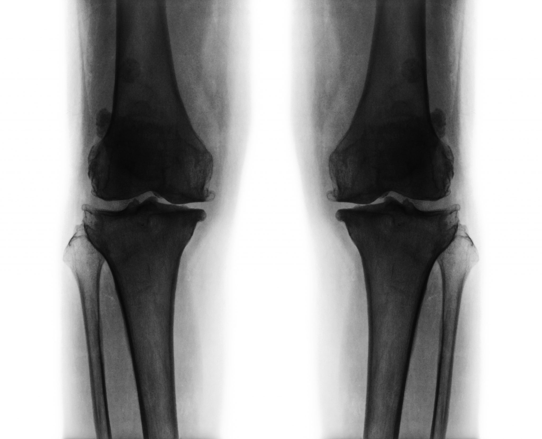 Osteoarthritis series part 2: treatment options - cssm