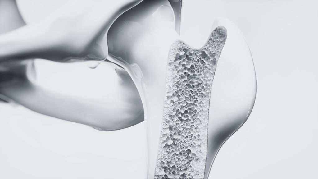 Osteopathy and osteoporosis - cssm