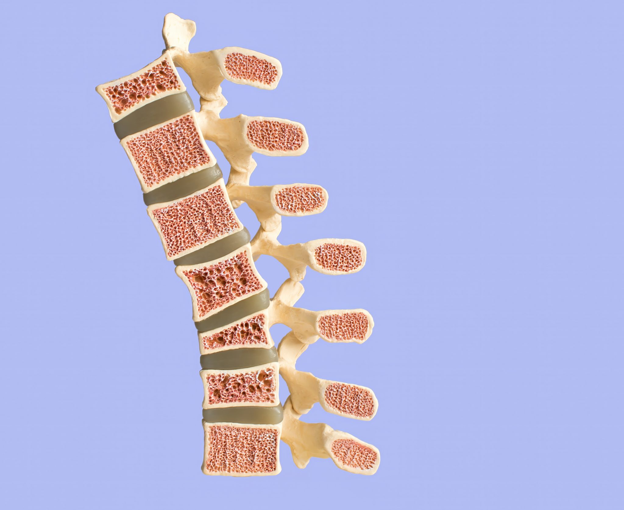 Osteopathy and osteoporosis - cssm